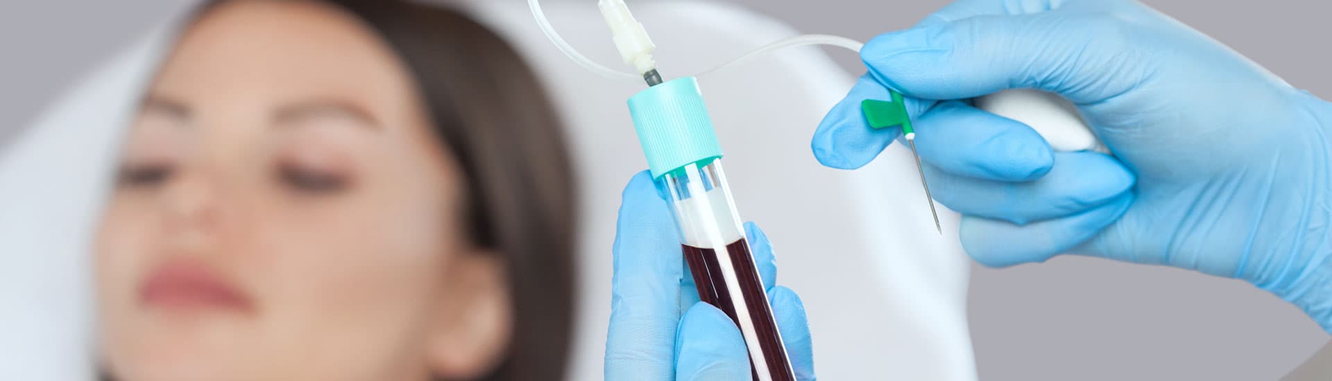 PRP Therapy at Revitalize You MD: Refresh Skin and Hair